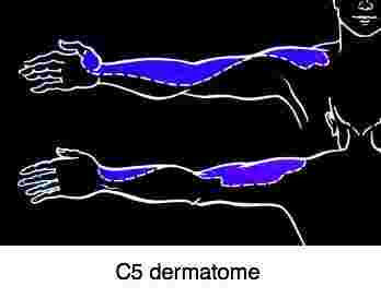 Tingling in arms and hands demands one must pay attention.