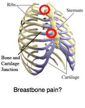 Tietzes syndrome casefile reveals a puzzling chest pain condition.