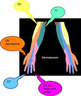 Elbow pain and tingling in 4th and 5th digit